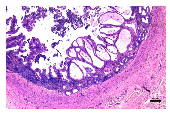 Contrast-Enhanced Ultrasound in Cystic Endometrial Hyperplasia–Pyometra ...