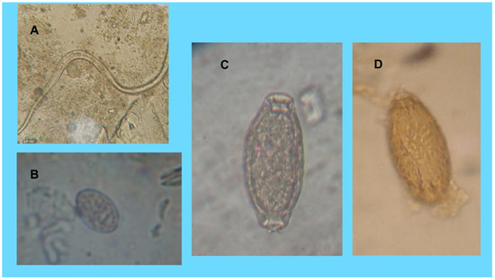 Pearsonema spp. (Family Capillariidae, Order Enoplida) Infection in ...