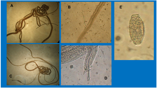 Pearsonema spp. (Family Capillariidae, Order Enoplida) Infection in ...