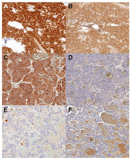 SDHB and SDHA Immunohistochemistry in Canine Pheochromocytomas