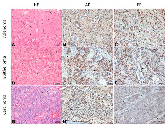 Androgen and Estrogen Receptor Expression in Different Types of ...