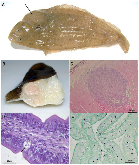 Diseases Caused by Amoebae in Fish: An Overview