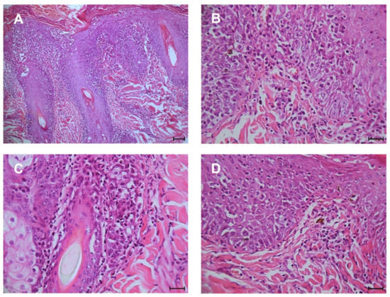 Increased Expression of Toll-Like Receptor 4 in Skin of Dogs with ...