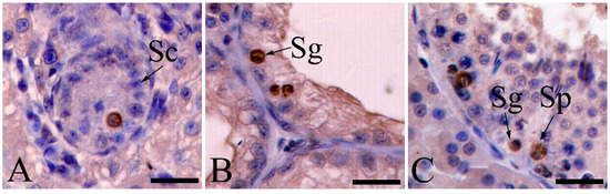 Effect of Cryptorchidism on the Histomorphometry, Proliferation ...