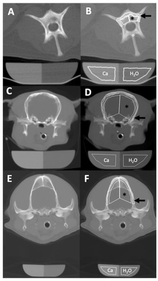 Computed Tomography Osteodensitometry for Assessment of Bone Mineral ...
