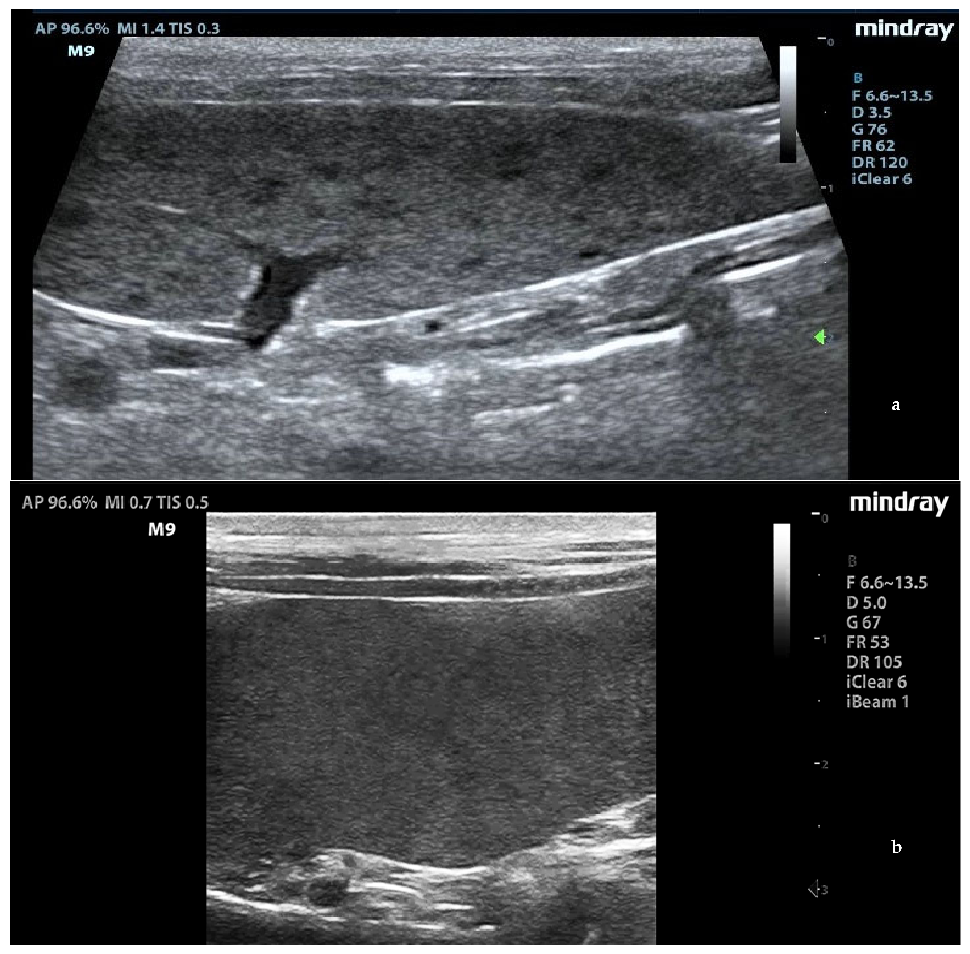 Bidimensional and Contrast-Enhanced Ultrasonography of the Spleen in ...