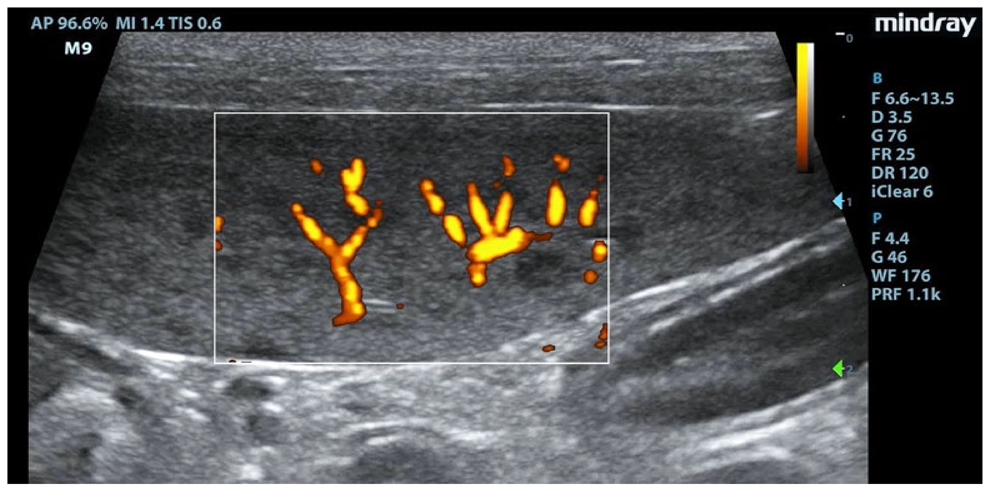 Bidimensional and Contrast-Enhanced Ultrasonography of the Spleen in ...