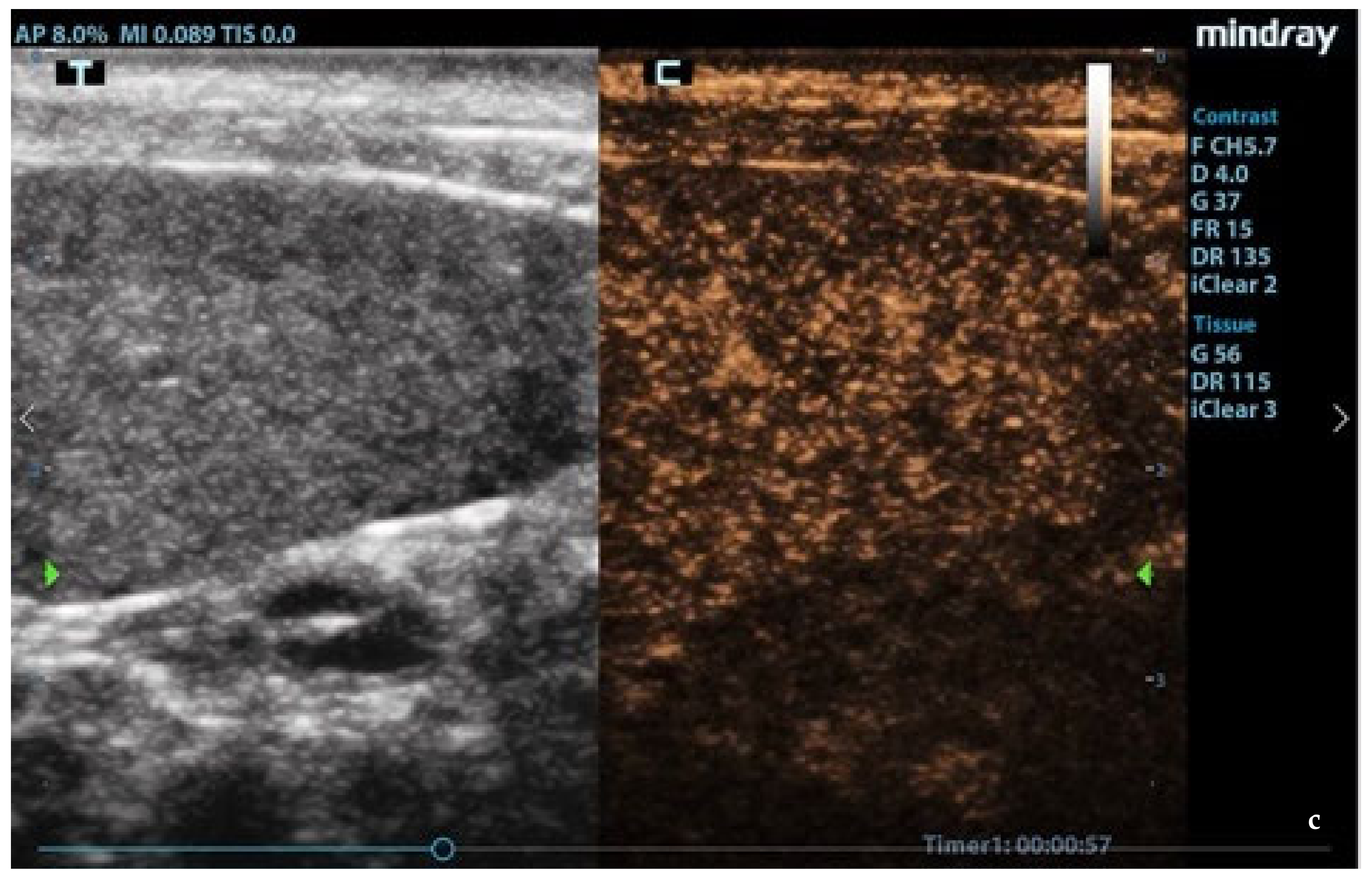 Bidimensional and Contrast-Enhanced Ultrasonography of the Spleen in ...