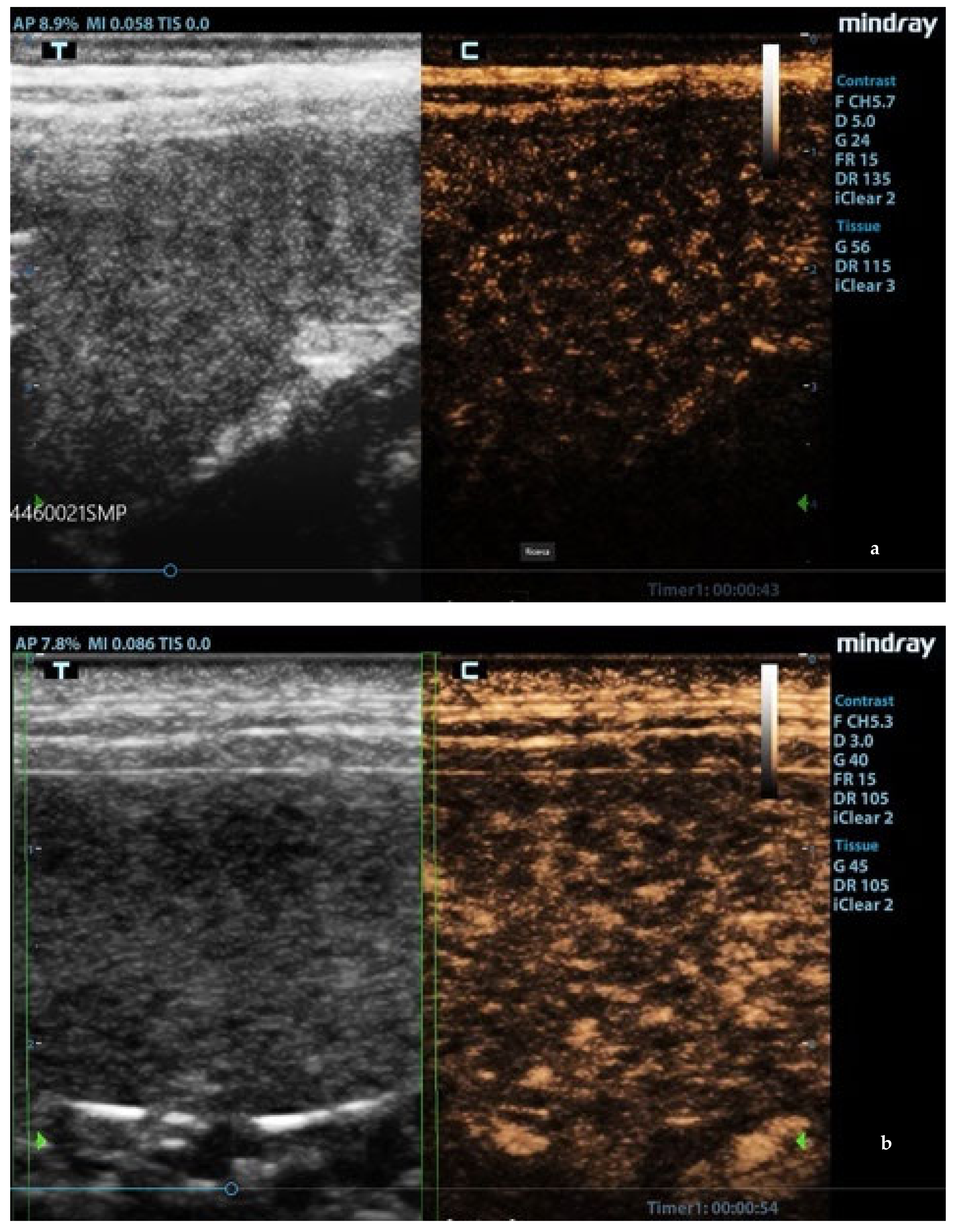 Bidimensional and Contrast-Enhanced Ultrasonography of the Spleen in ...