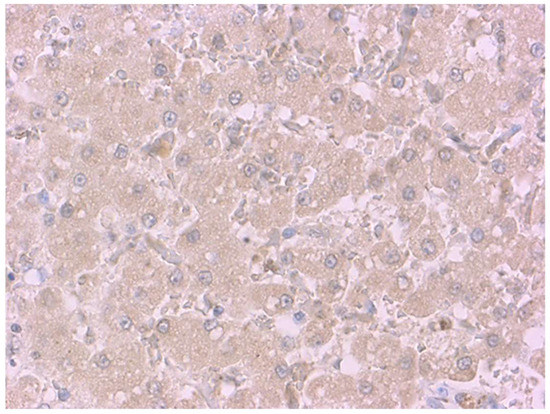 Abnormal Prothrombin (PIVKA-II) Expression in Canine Tissues as an ...