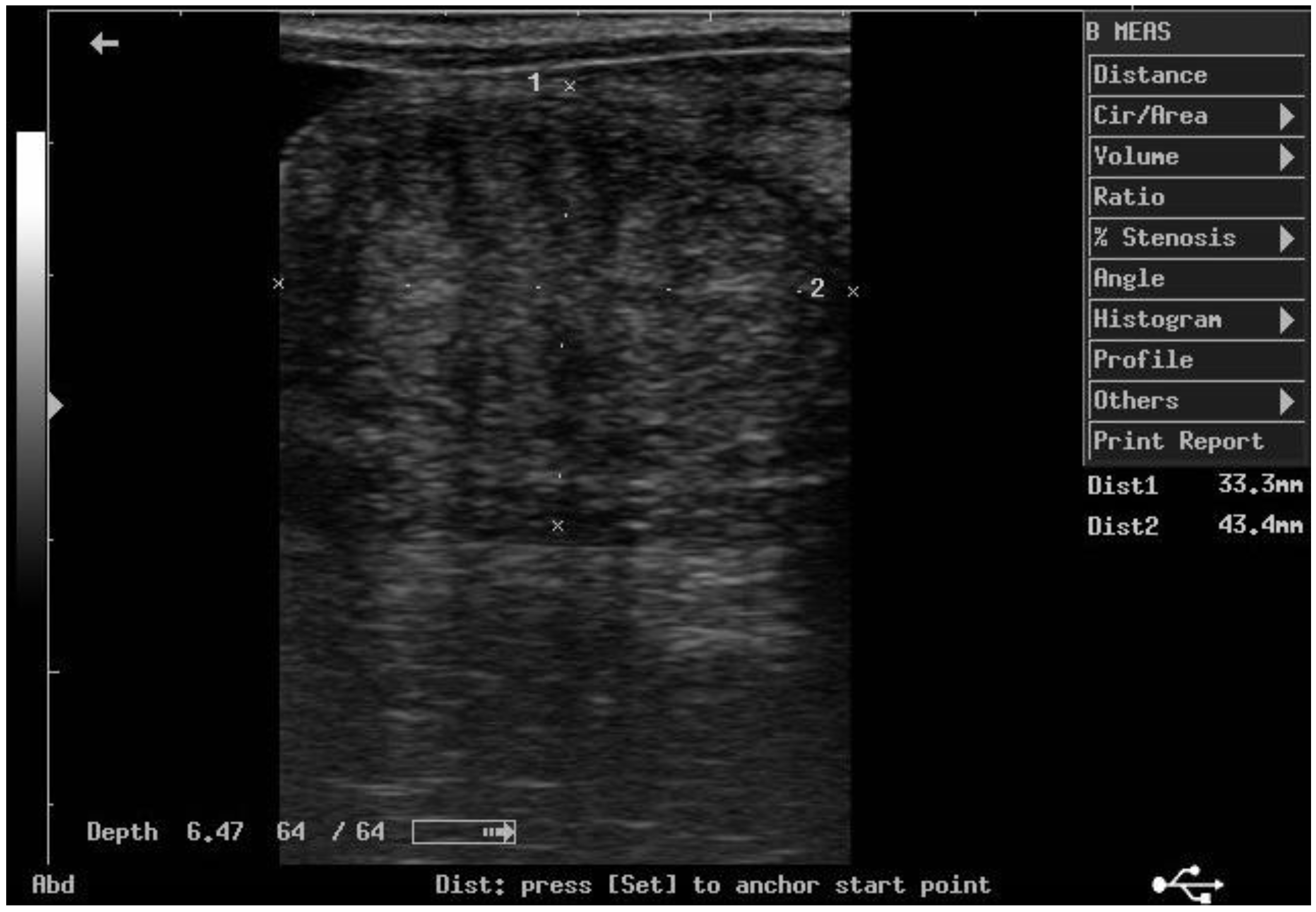 Postpartum Uterine Involution in Martina Franca Jennies