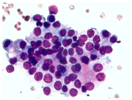 Animals | Free Full-Text | Ultrasound-Guided Radiofrequency Ablation of ...