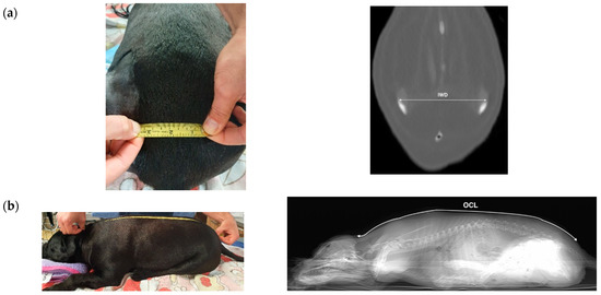 Mathematical Models for the Skin to Lumbosacral Epidural Distance in ...