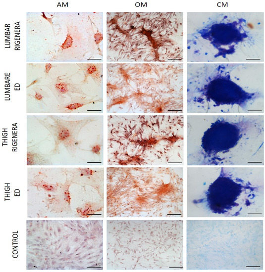 In Vitro Characterization of Canine Microfragmented Adipose Tissue Non ...