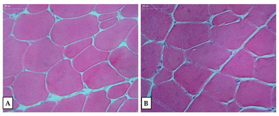 Growth Performance, Carcass Characteristics and Meat Quality of ...