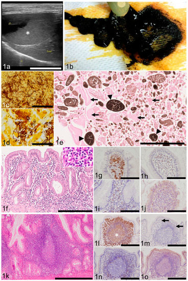Chronic Cholecystitis of Dogs: Clinicopathologic Features and ...