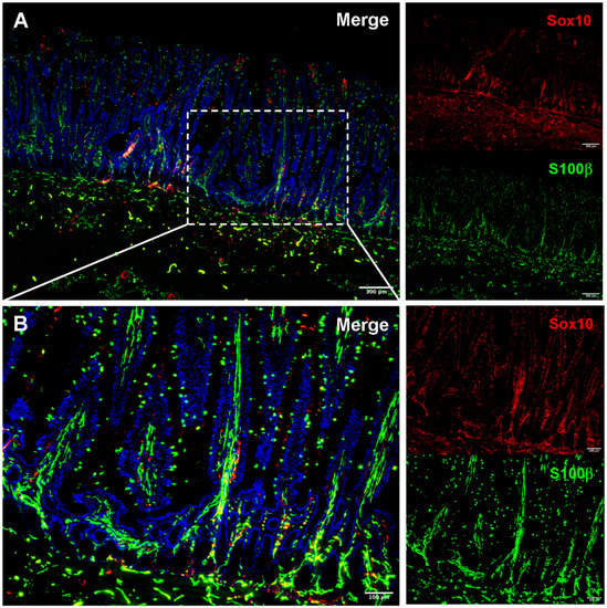 Animals | Free Full-Text | Age-Dependent Intestinal Repair ...