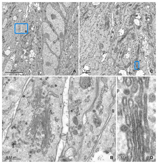 Field-Emission Scanning Electron Microscope as a Tool for Large-Area ...