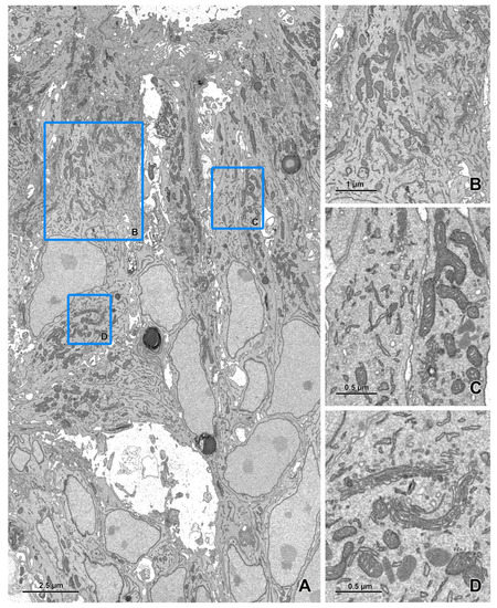 Field-Emission Scanning Electron Microscope as a Tool for Large-Area ...
