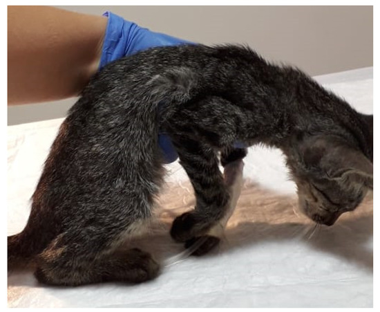 Hemorrhagic Meningoencephalomyelitis Due to Ectopic Localization of ...