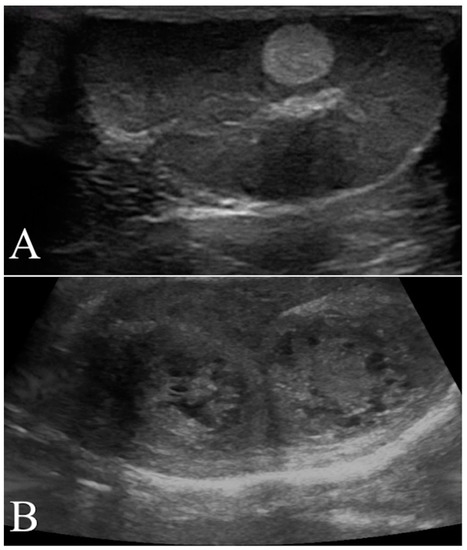 Characterization of Testicular Tumor Lesions in Dogs by Different ...