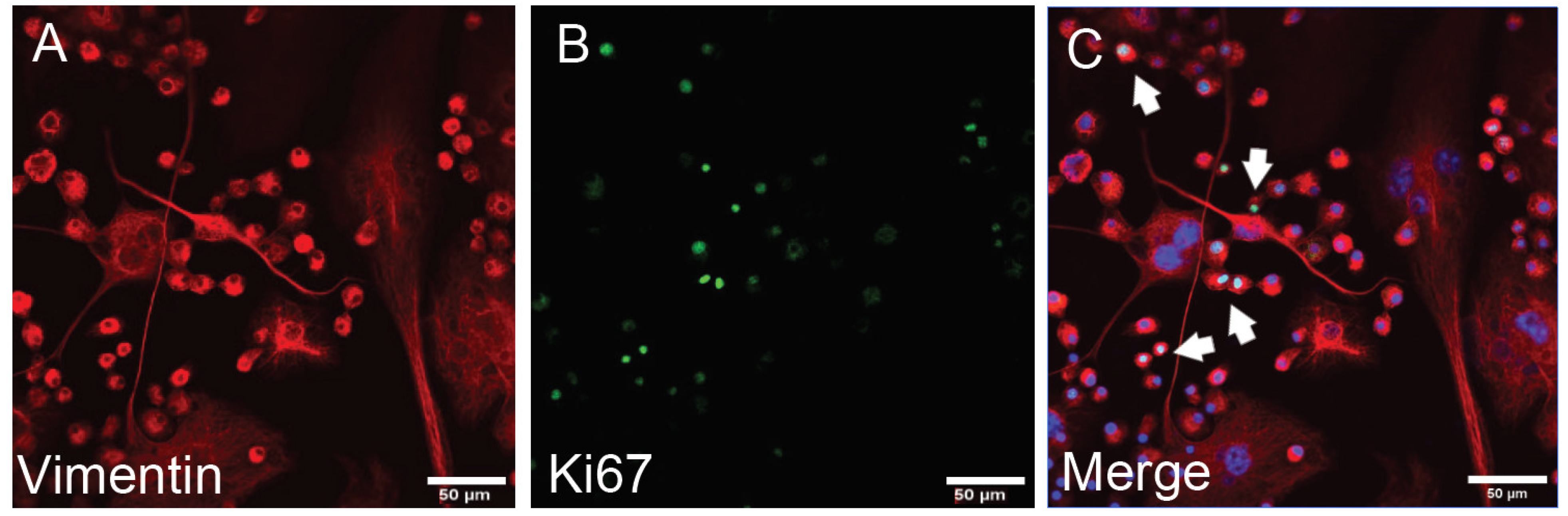 Testicular Localization and Potential Function of Vimentin Positive ...
