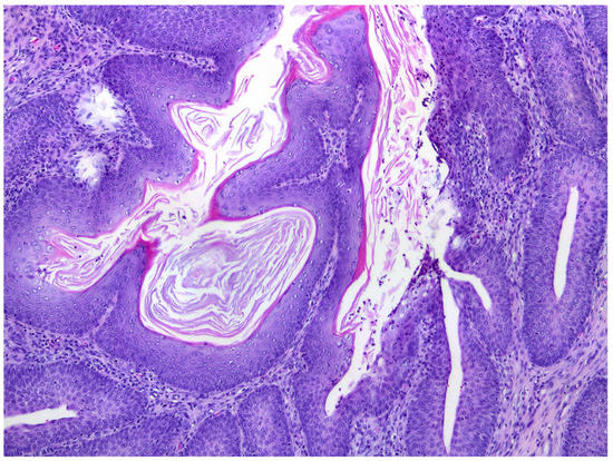 Lower-Than-Expected Vitamin A Concentrations in a Commercial Diet ...