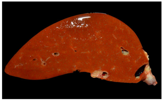 Yellow Lamb Disease (Clostridium perfringens Type A Enterotoxemia of ...