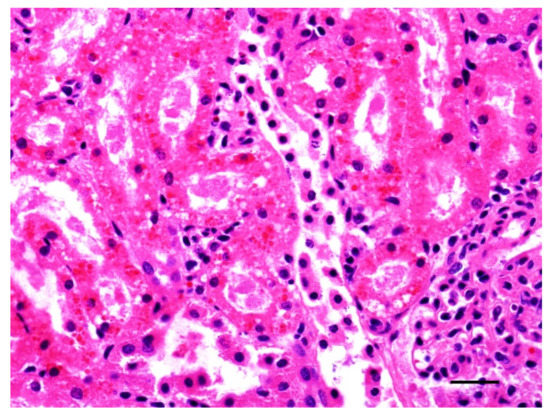 Yellow Lamb Disease (Clostridium perfringens Type A Enterotoxemia of ...