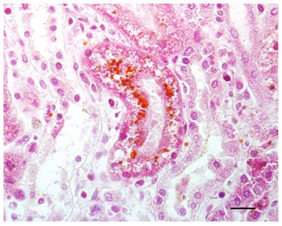 Yellow Lamb Disease (Clostridium perfringens Type A Enterotoxemia of ...