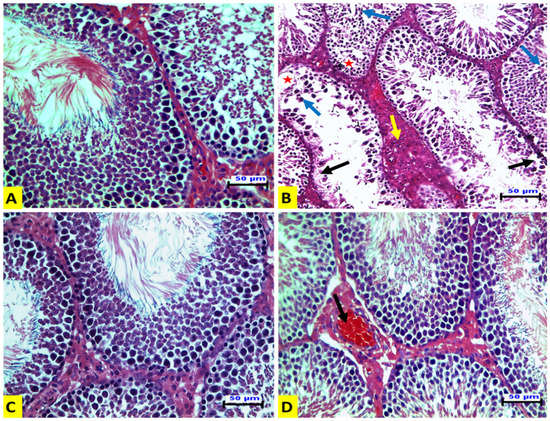 Reproductive Injury in Male Rats from Acrylamide Toxicity and Potential ...