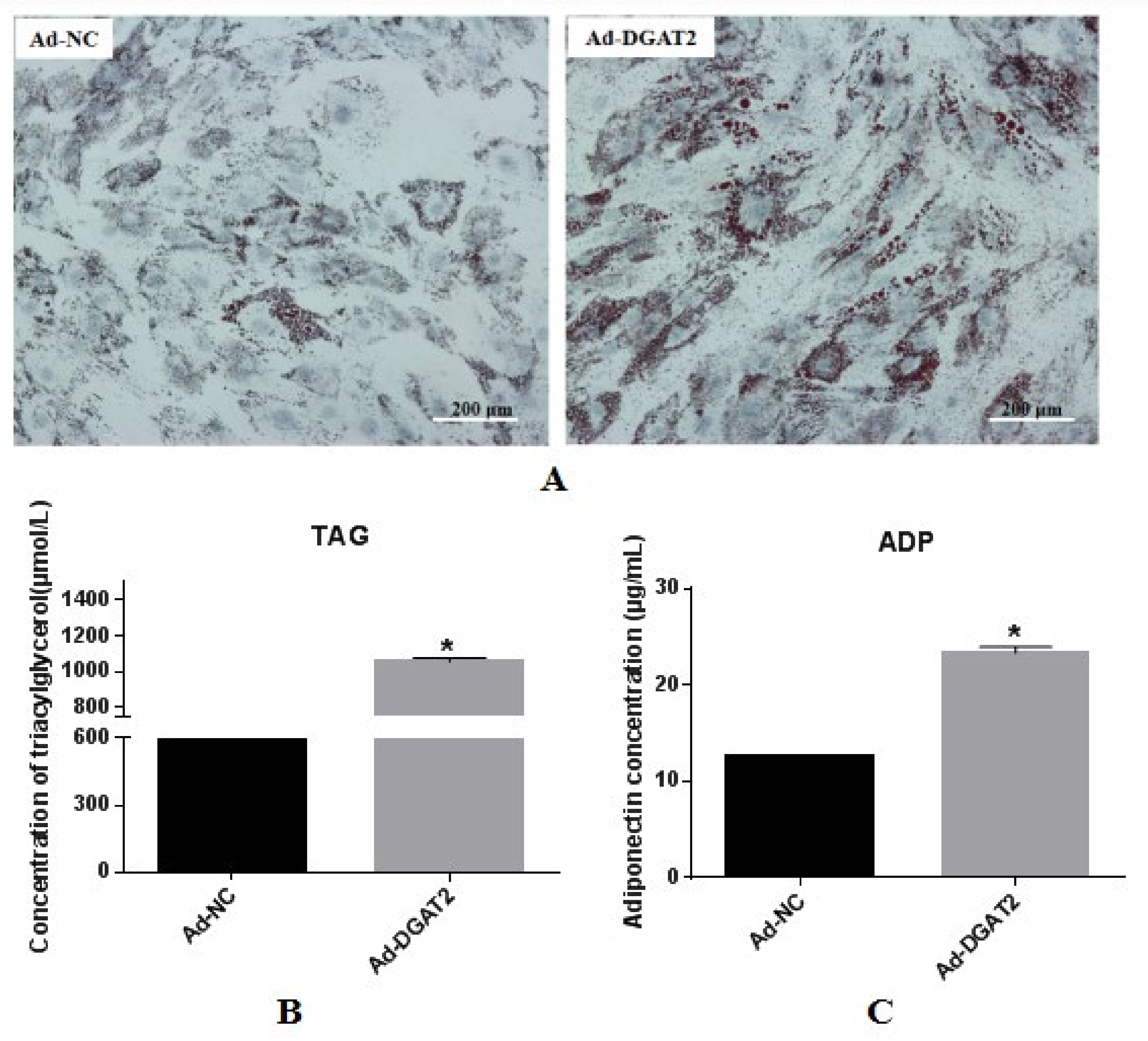 Overexpression of DGAT2 Stimulates Lipid Droplet Formation and ...