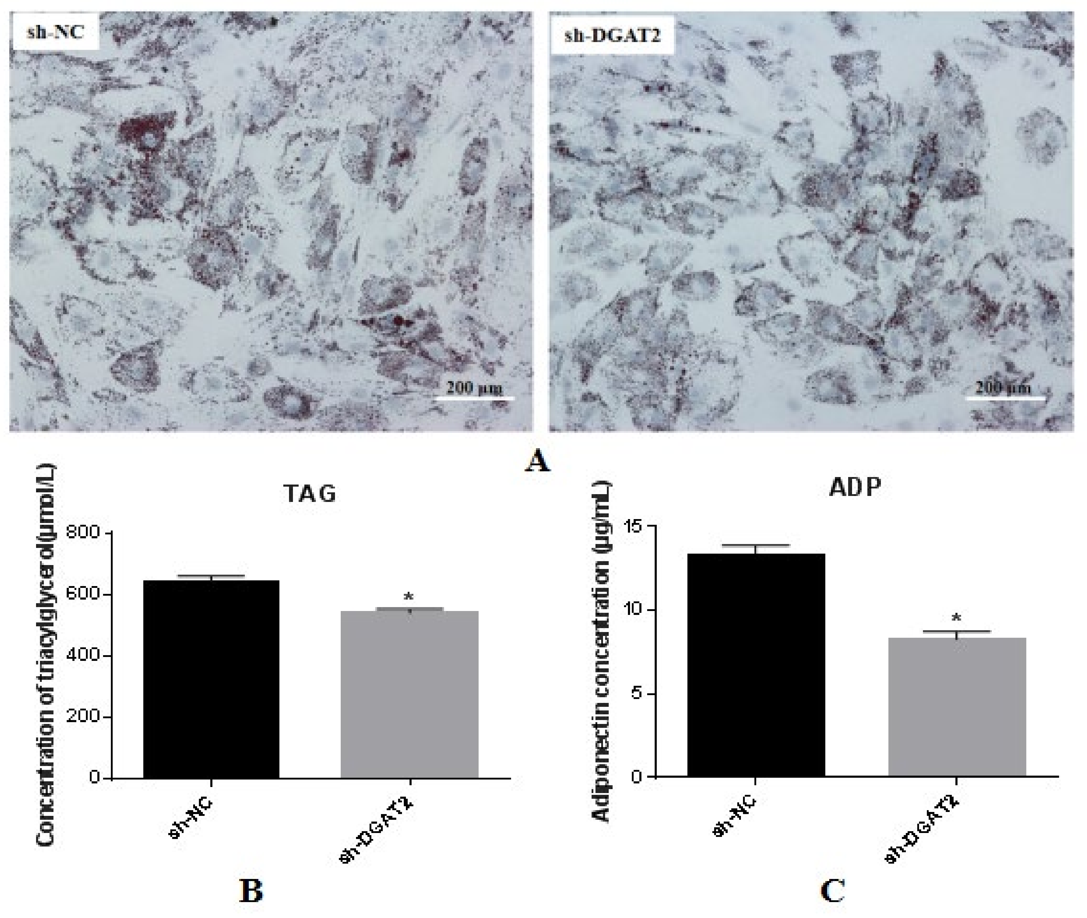 Overexpression of DGAT2 Stimulates Lipid Droplet Formation and ...