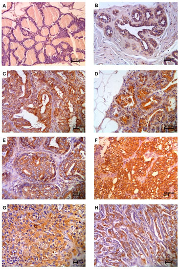 Immunohistochemical Expression of p62 in Feline Mammary Carcinoma and ...
