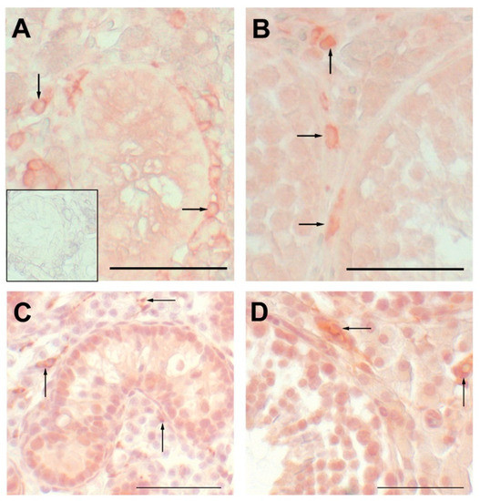 Expression of CSF1, AR, and SRD5A2 during Postnatal Development of the ...