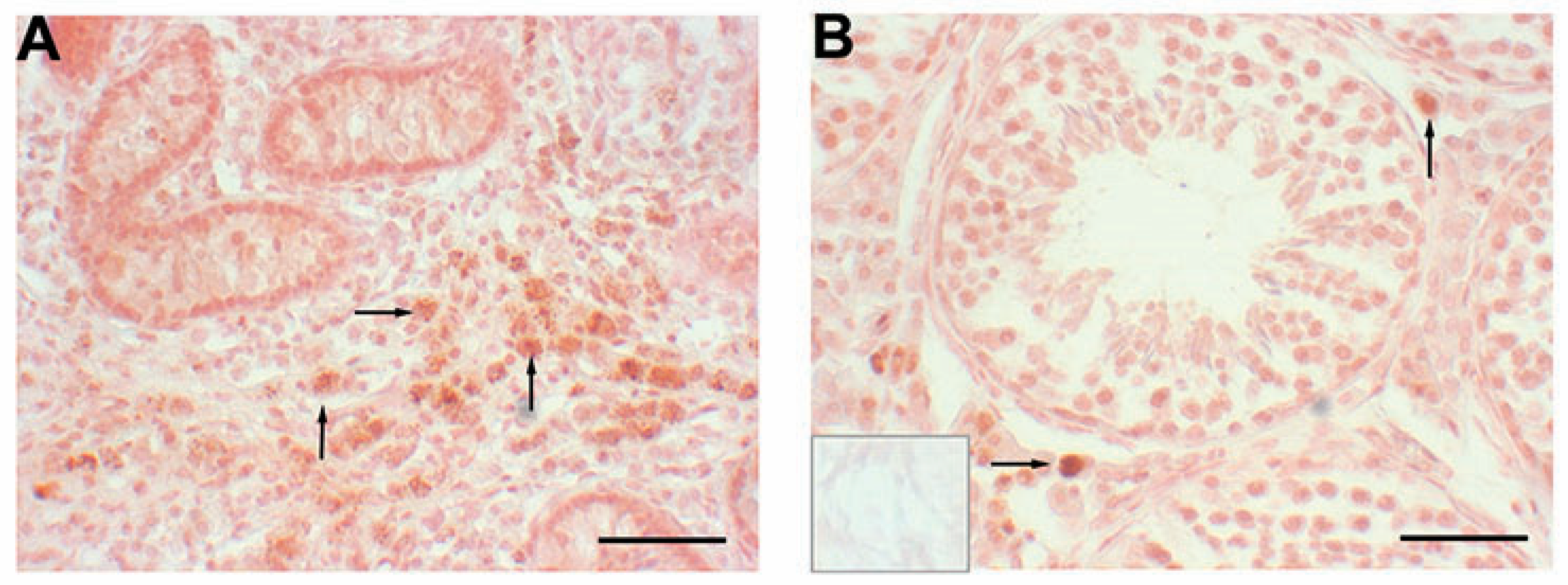 Expression of CSF1, AR, and SRD5A2 during Postnatal Development of the ...