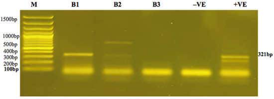 Propagation of Babesia bigemina in Rabbit Model and Evaluation of Its ...