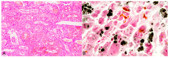 Copper Poisoning, a Deadly Hazard for Sheep