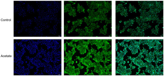 Acetate-Induced Milk Fat Synthesis Is Associated with Activation of the ...