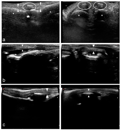 Common Digital Extensor Tendon Injury in Three Sporting Dogs