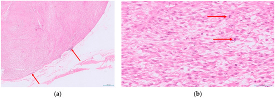 Feline Soft Tissue Sarcomas: A Review of the Classification and ...