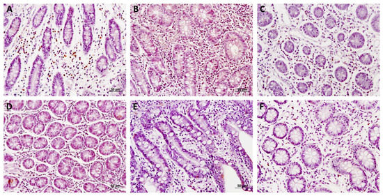 Oral and Parenteral Vaccination against Escherichia coli in Piglets ...