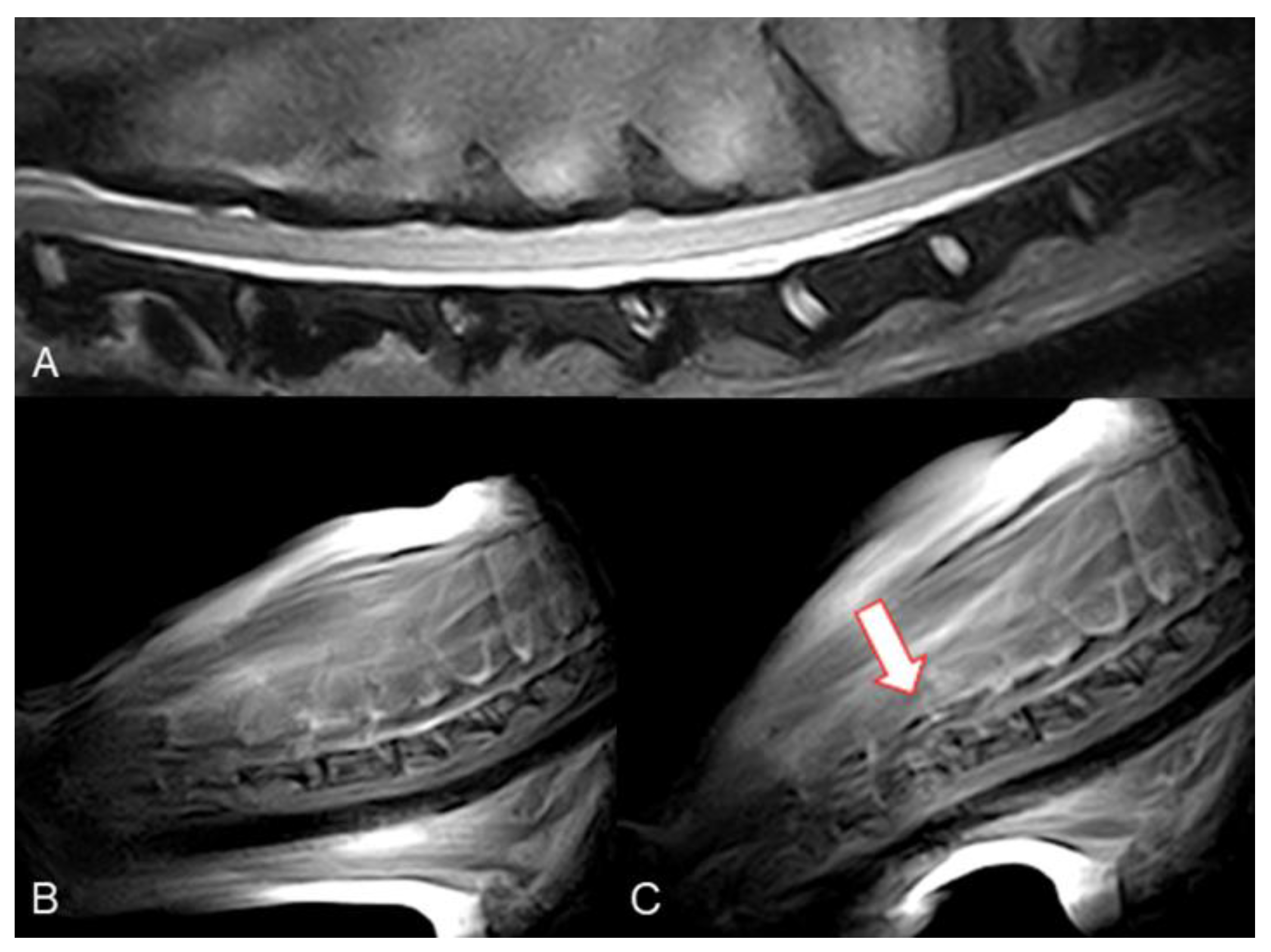 Development of Real-Time Kinematic Magnetic Resonance Imaging (kMRI ...