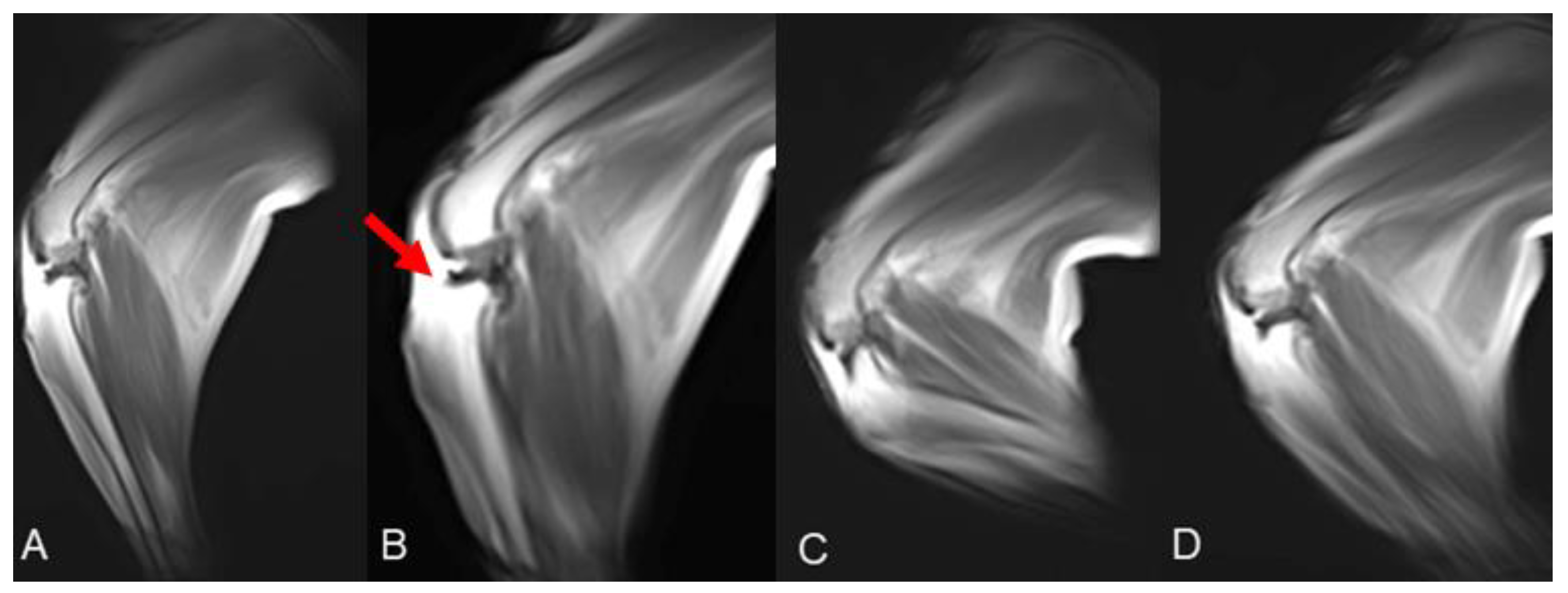 Development of Real-Time Kinematic Magnetic Resonance Imaging (kMRI) Techniques for Studying the ...