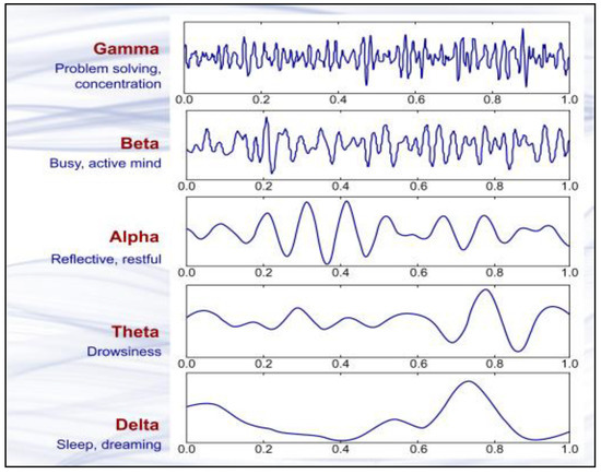 Application of Electroencephalography in Preslaughter Management: A Review