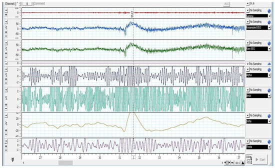 Application of Electroencephalography in Preslaughter Management: A Review