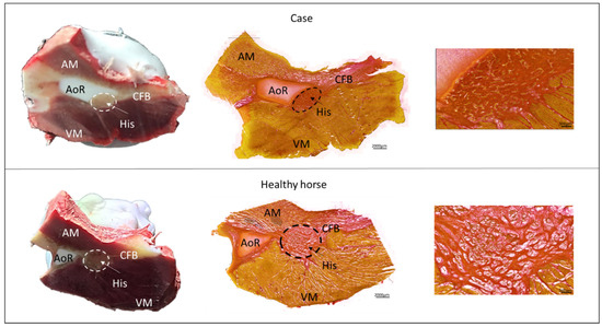 Cartilaginous Intrusion of the Atrioventricular Node in a Quarter Horse with a High Burden of ...