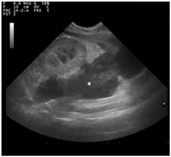 Nontraumatic Paraureteral Urinoma in a Cat with Urolithiasis