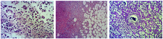 Nontraumatic Paraureteral Urinoma in a Cat with Urolithiasis