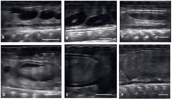 Ultrasound Description of Follicular Development in the Louisiana ...